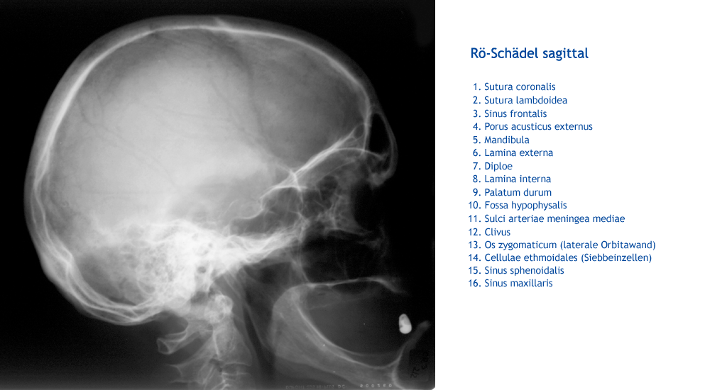 RÖ-Schädel sagittal