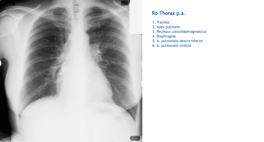 RÖ-Thorax p.a