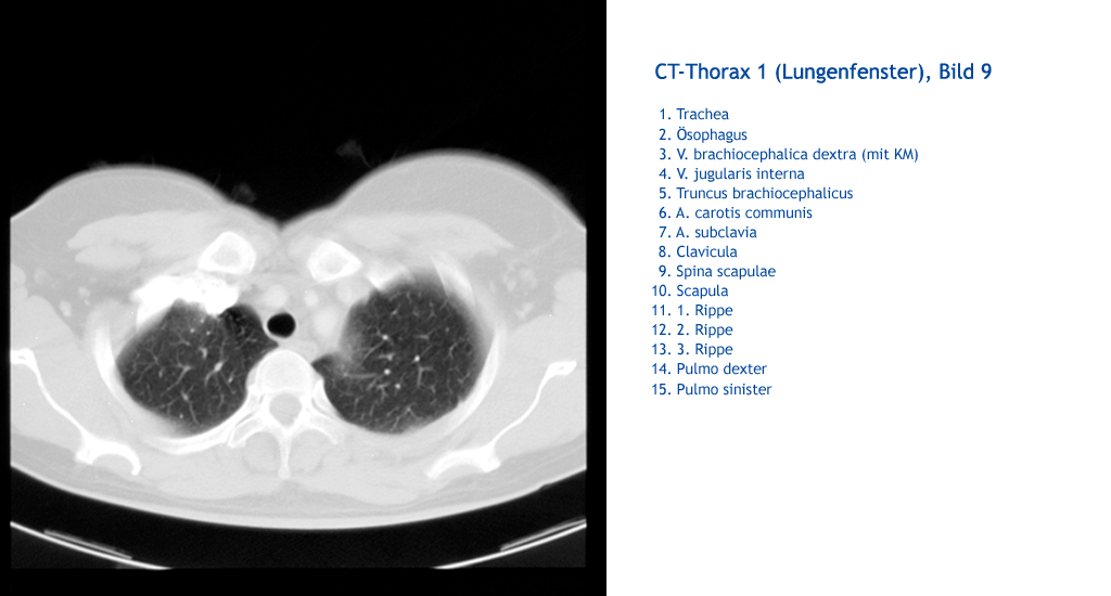 CT Thorax 1, Bild 09